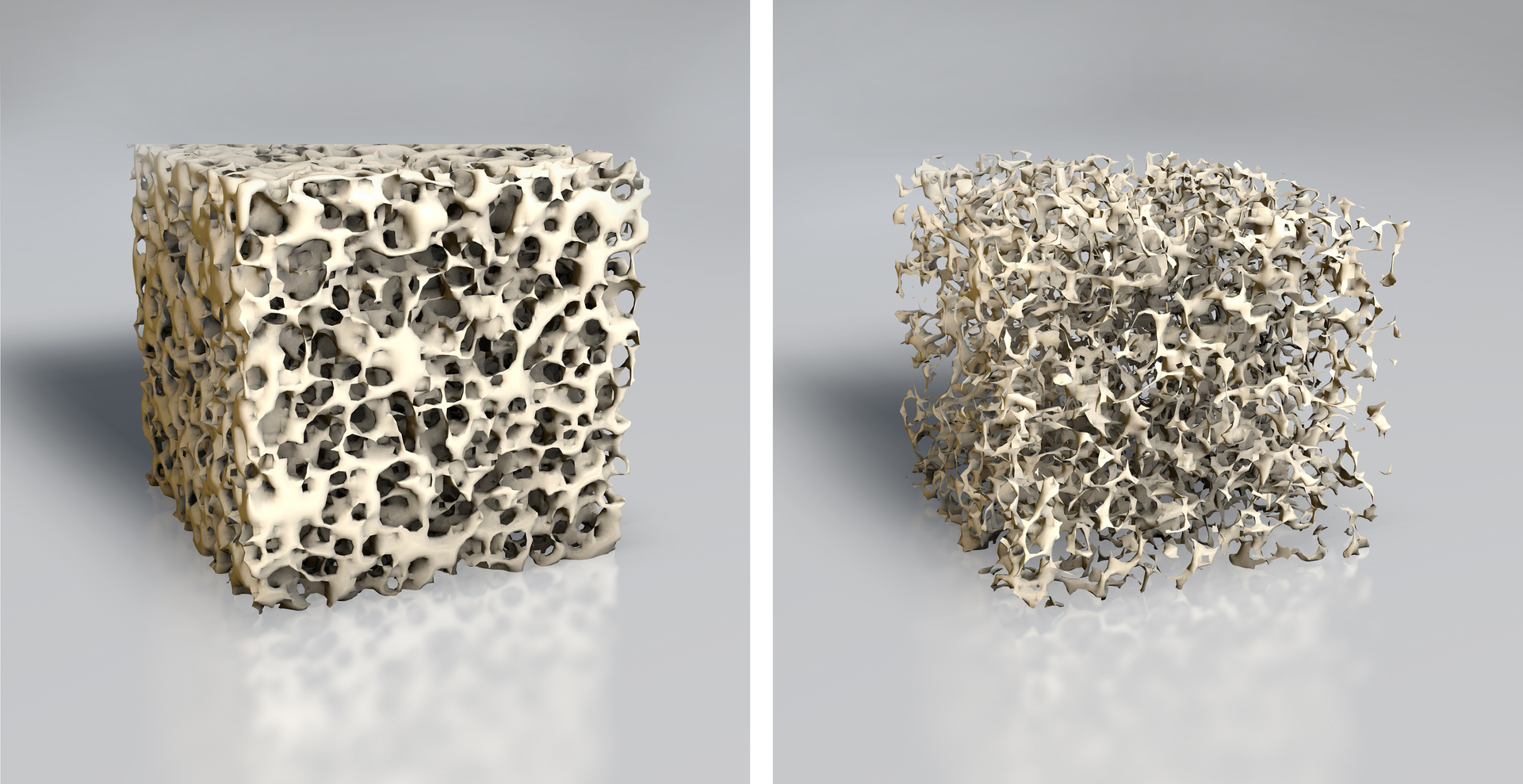 Wapń – niezbędny budulec dla zdrowia kości | Lifelinediag