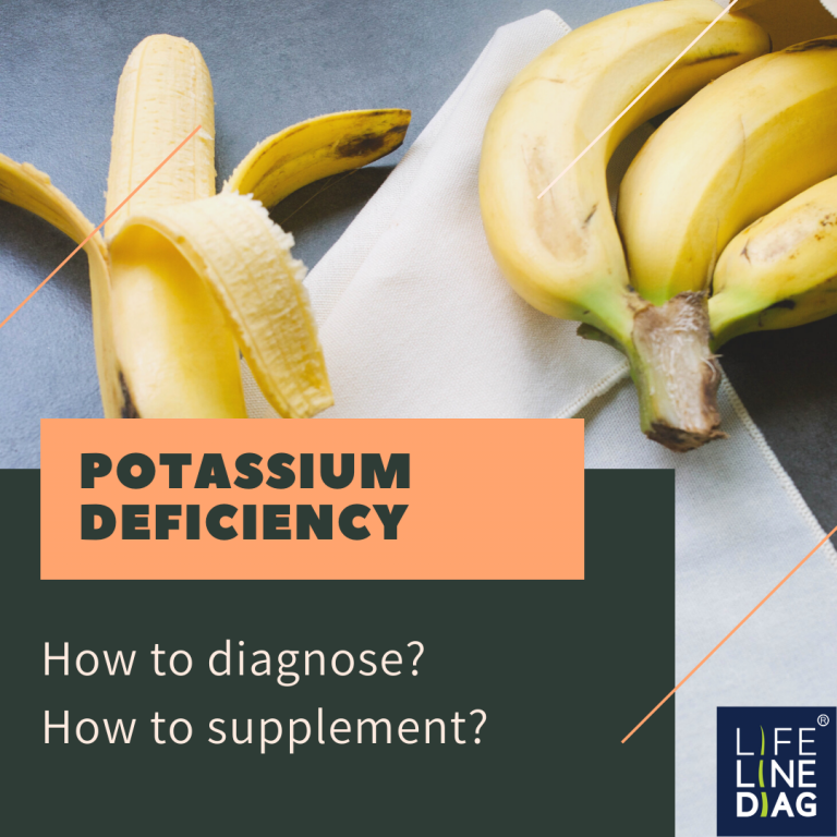 Potassium deficiency – how is it diagnosed? How can you supplement ...